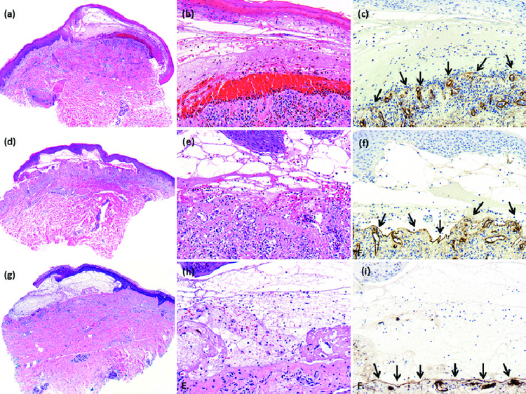 Routine Histopathology Steps – Innovative Medi Tech