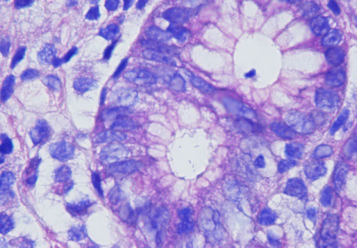 GIEMSA for Hp for Helicobacter pylori 75 test - Special Stains ...