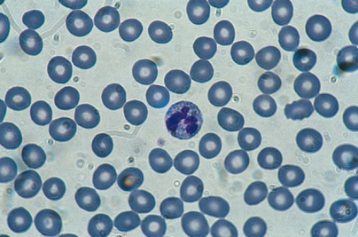 MGG quick stain (Diff Quick) – Innovative Medi Tech